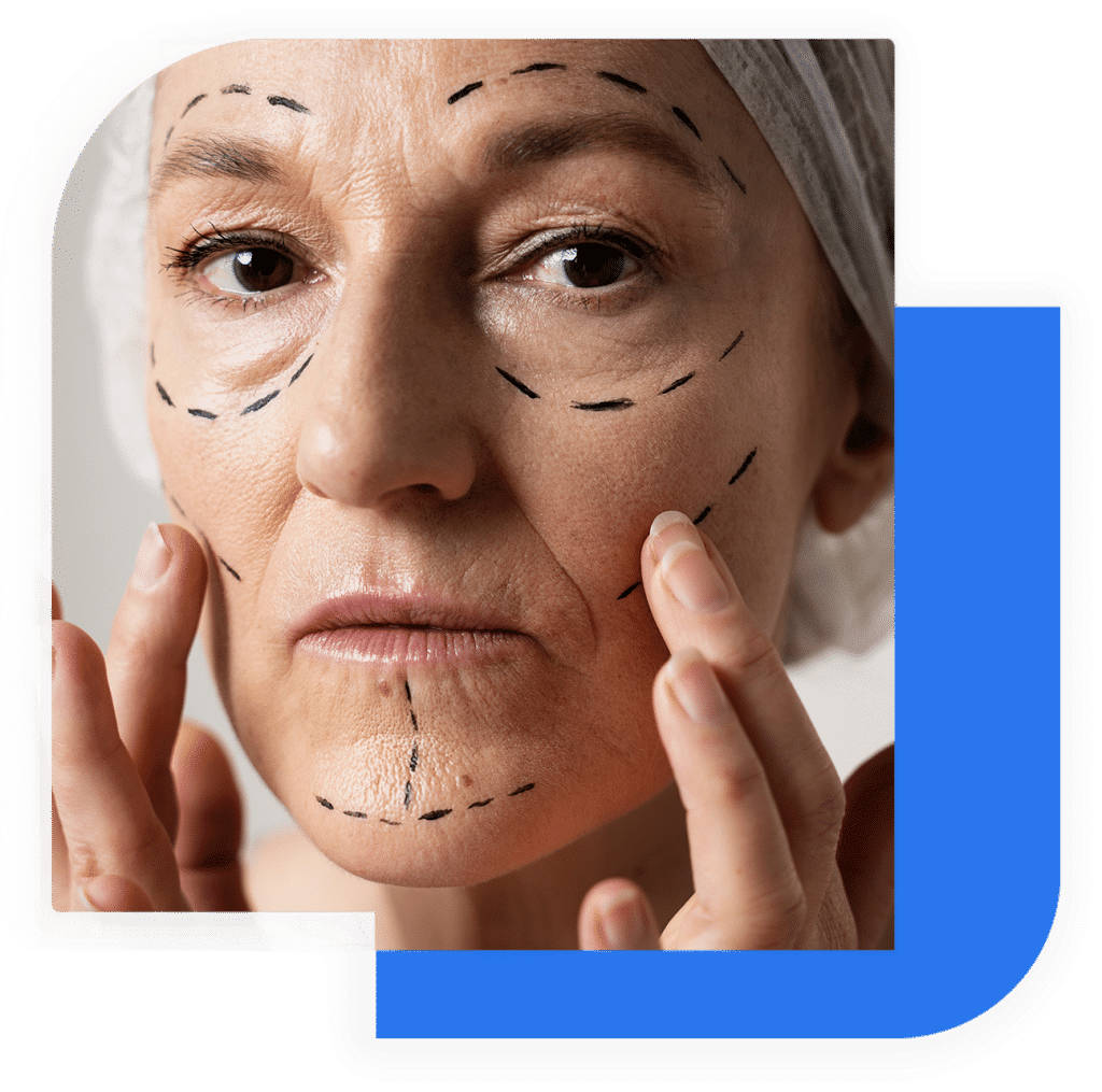 Face Lift Turkey - starts from £2,499 - Clinic Prime - Book a Free ...